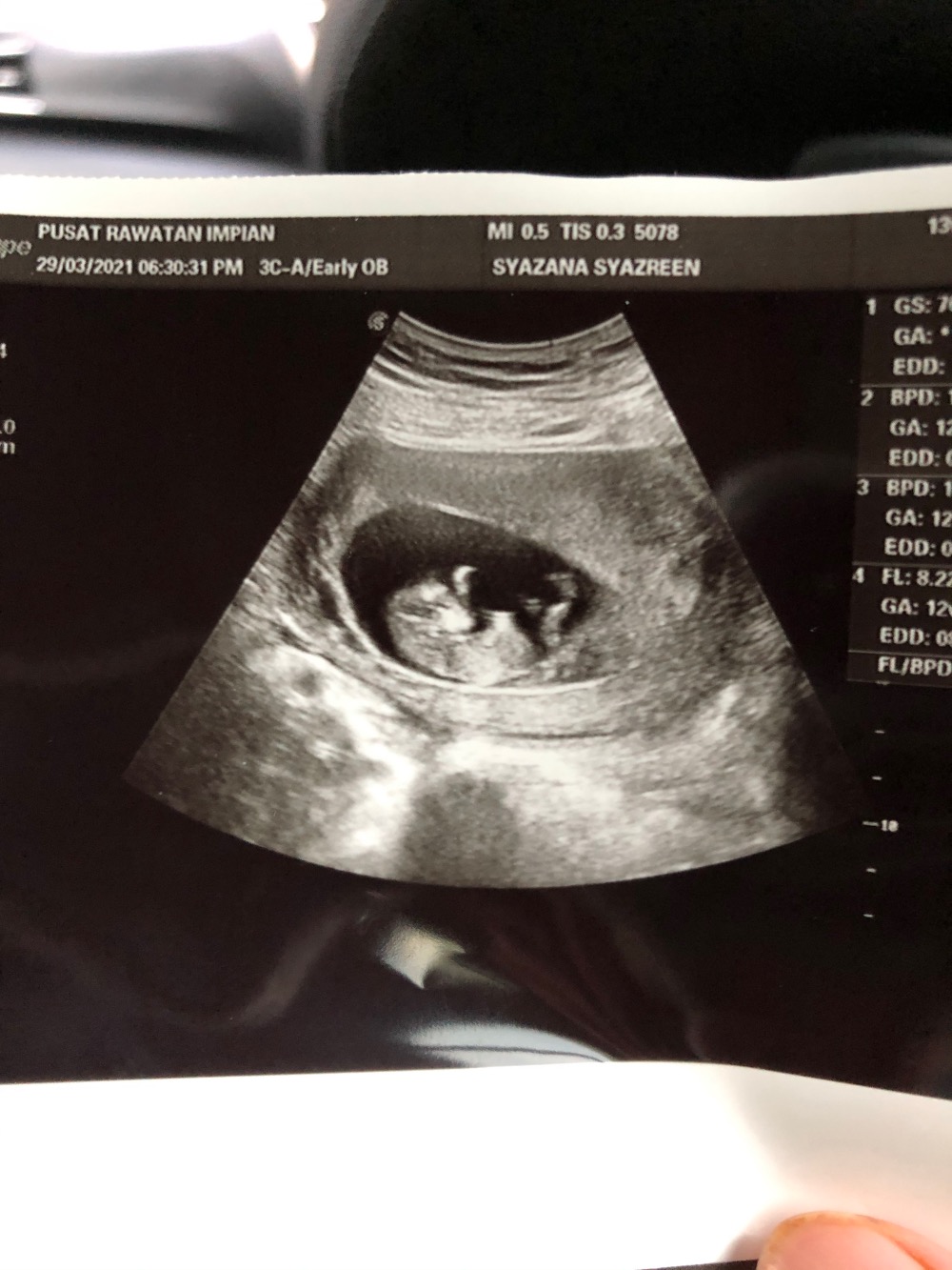 Baby #2 + 1st trimester update! • Everyday Ereen